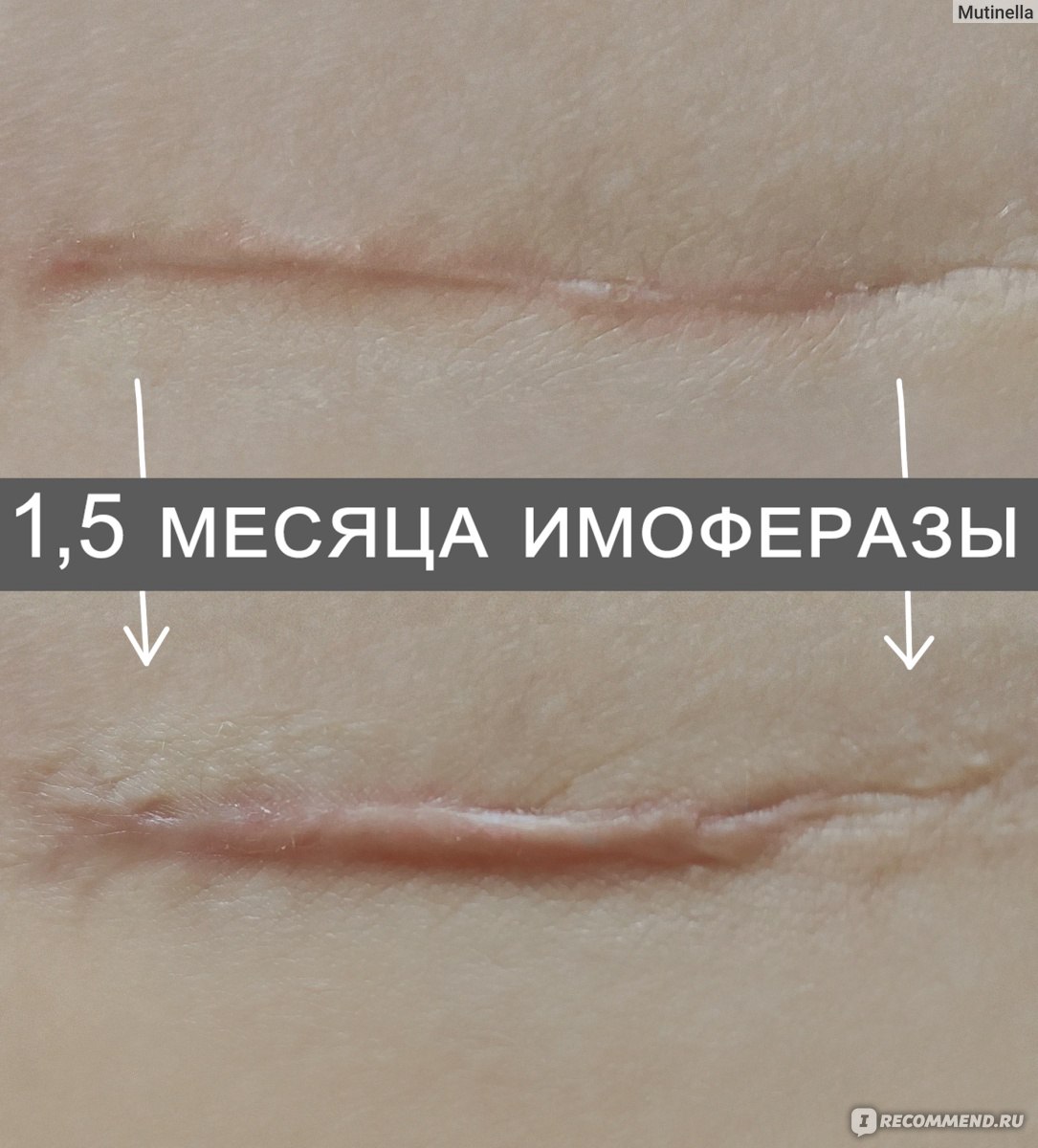 Крем НПО Петровакс Фарм Имофераза - «Покажу как под воздействием ...