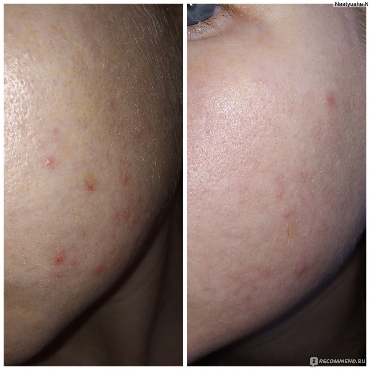 Сыворотка для лица LEFAMI C-BRIGHT melanin serum для выравнивания тона ...